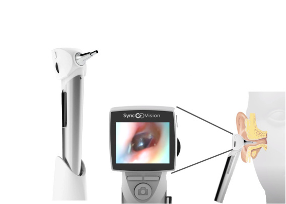 Otoskop cyfrowy iO1 Elite SyncVision Videootoskop Sprzęt medyczny ...